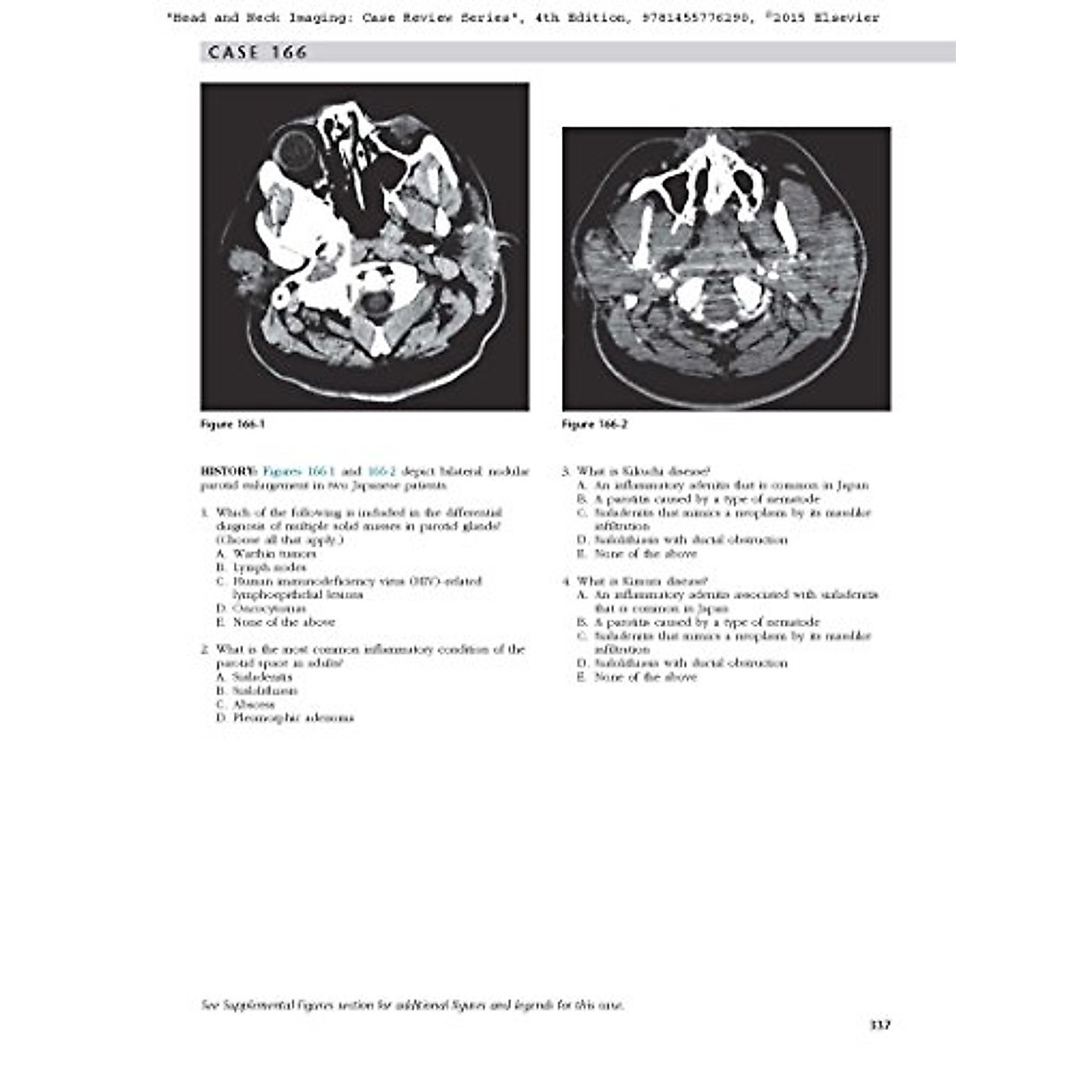 Head and Neck Imaging: Case Review Series