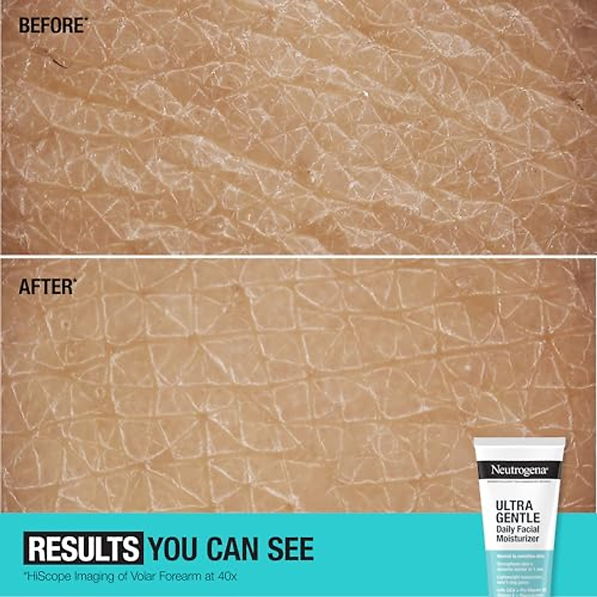 Neutrogena Fragrance Free Daily Facial Moisturizer, Face Moisturizer for Sensitive & Dry Skin with Vitamin B3, Pro-Vitamin B5 & Vitamin E, Supports Skin's Dynamic Barrier, 3.4 fl. oz