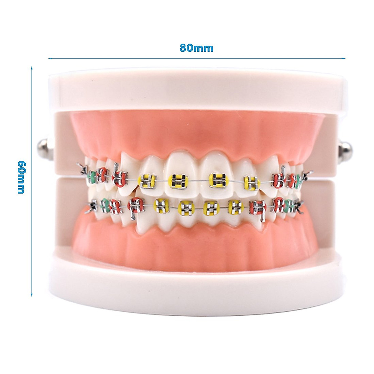 Angzhili 1 Piece Dental Demonstration Orthodontic Model with Metal Wires and Bracket (Metal bracket)