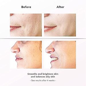 AURA Light Therapy Mask - Soft and Light-Weight - Latest 4 Colors LED Face Mask Light Therapy to Address Different Skin Care Needs - Beauty & Personal Care at the Comfort of Your Home