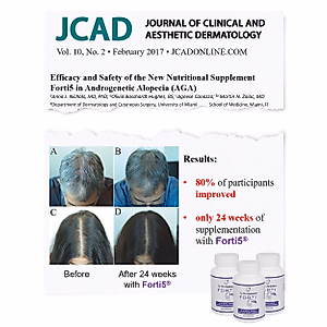 Quintessence Forti5 Hair Growth Nutritional Supplement and Vitamins with 5 Plus1 Key Substances, 1 Month Supply - 60 Caps.