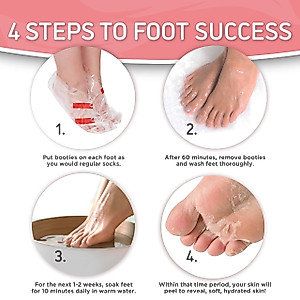 Soft Touch Foot Peel Mask - Pack of 2 Feet Peeling Masks for Dry, Cracked Heels & Calluses - Exfoliating Foot Mask Peel for Baby Soft Skin (Original)