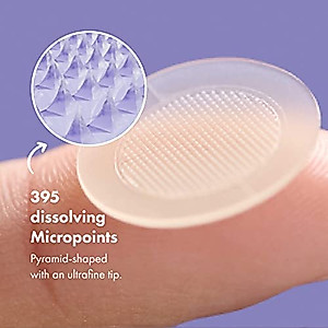 Mighty Patch Micropoint for Dark Spots from Hero Cosmetics - Post-Blemish Dark Spot Patch with 395 Micropoints, Dermatologist Tested and Non-irritating, Not Tested on Animals (8 Count)