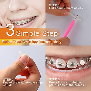 Aoutrow12 PACK Braces Wax Dental Wax with Colorful Storage Cases, 60 Orthodontic Wax Strips for Braces Aligners Wearer