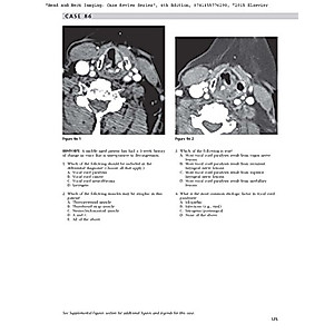 Head and Neck Imaging: Case Review Series