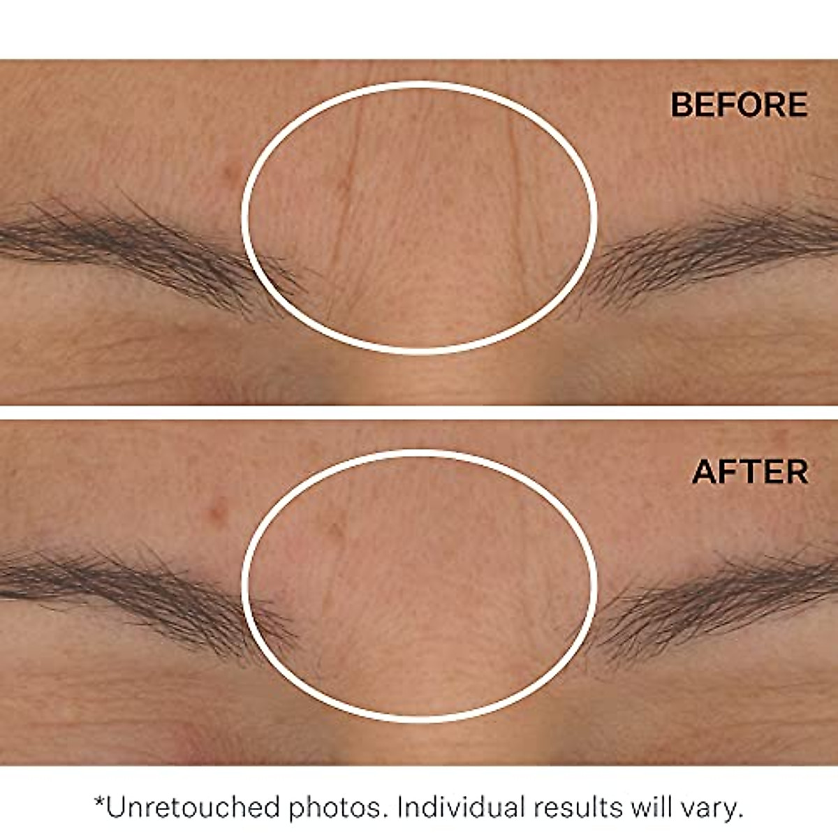 StriVectin Advanced Retinol Star Light Night Oil with Squalane, Improves Skin Texture, Wrinkles, Firmness and Dehydration, 1 Fl Oz (Pack of 1)