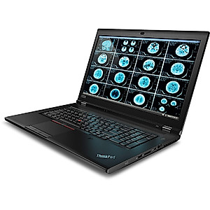Lenovo ThinkPad P73 Workstation Laptop (Intel i7-9750H 6-Core, 16GB RAM, 512GB SATA SSD, Quadro P620, 17.3" Full HD (1920x1080), Fingerprint, 3xUSB 3.1, 1xHDMI, Win 10 Pro) with USB3.0 Hub