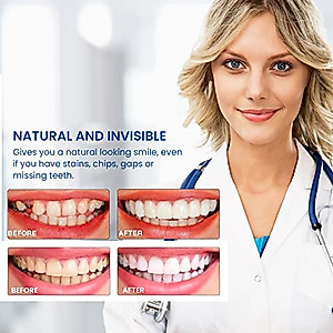 Fake Teeth - Fake Braces - Veneers Teeth for Women and Men - 4 PCs Smile Kit - Temporary Teeth Restoration - Snap on Veneers False Teeth, Dentures for Women, Swift Smile Snap on Teeth Snap-on Smile