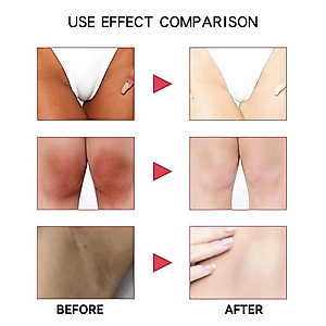 Snow Bleach Cream,Snow Bleach Cream Private Part (5Bottle)