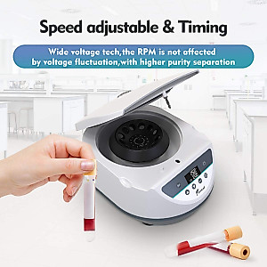 Benchtop Centrifuge Machine for PRP Digital Lab Centrifugadora de Plasma 2ml/5ml/ 10ml /15mlx8 Capacity,500-5000rpm|3074xg w/Timer
