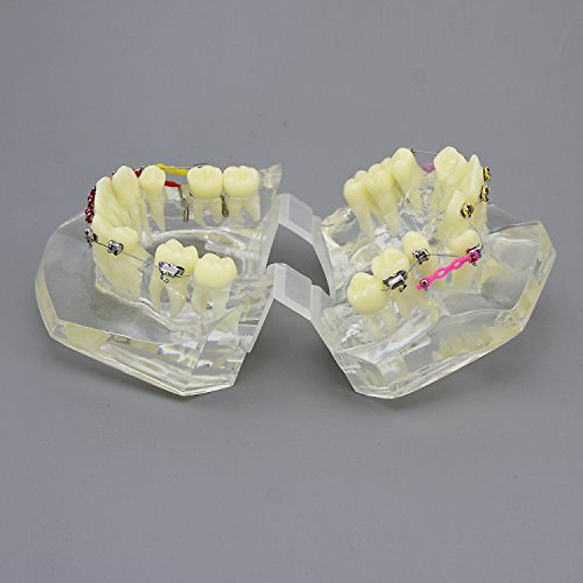 Smile1000 Dental Malocclusion Orthodontic Treatment Teeth Model with Metal Brackets Wires Colorful Ties Chains and Hoops M3005