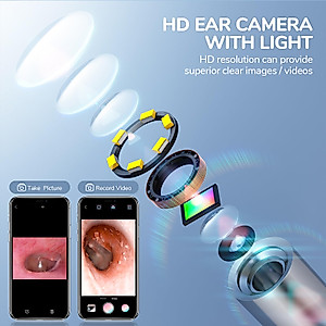ScopeAround Otoscope, 3.9mm Ultra-Thin Ear Camera with 6 LED Lights, Digital Otoscope with Ear Wax Removal Tool, USB Plug & Play Ear Wax Camera Compatible with iPhone 15/Android