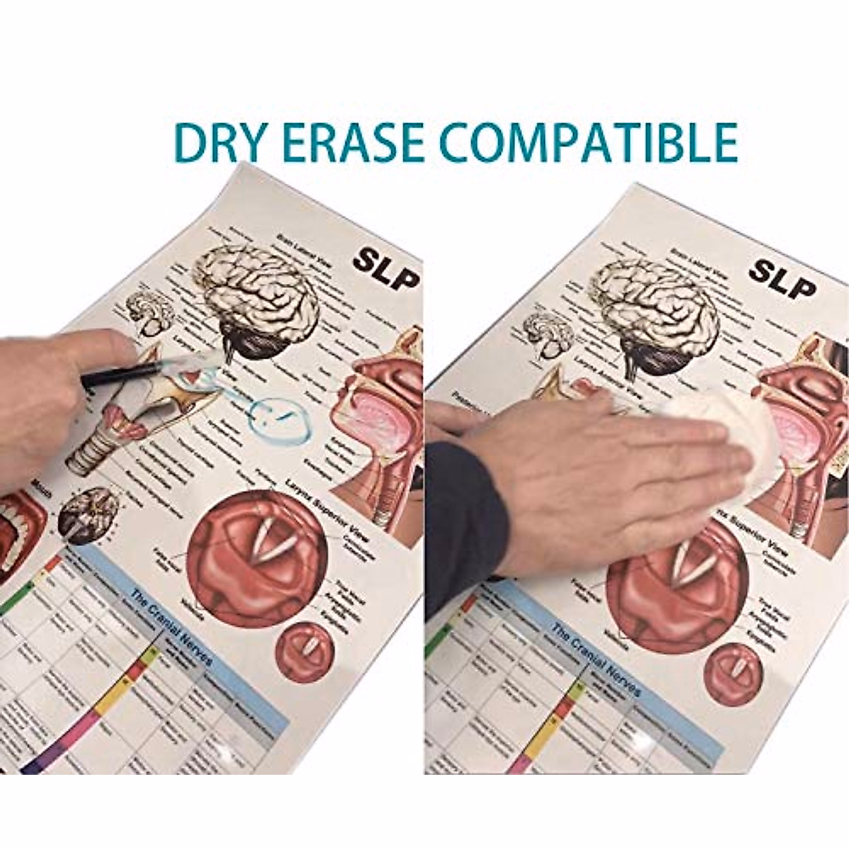 Blue Tree Publishing Larynx LP Poster, voice, education, vocal folds, mouth, head cutview, vocal pathology, size 24Wx36T