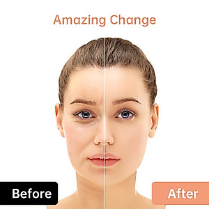 AIBOKEE 2 in 1 Face Massager Electric, 3D Face Massager Roller and T Shape Facial Massager Roller Vibrating,Skincare Tools for Face Arm Eye Waist Leg,Powered by One AA Battery（2 Piece Set）