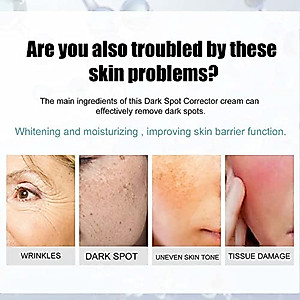 3 Pack Dark Spot Cream For Face,Dark Spot Remover For Melasma,Skin Spot Remover Cream,Freckle Remover Cream,Age Spot Remover,Dark Spot Cream For Women & Men (2 Pack)