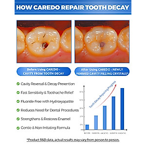 CAREDO Cavity Reversal Hydroxyapatite Toothpaste for Adults, Cavity Tooth Filler as Home Cavity Repair, Fluoride Free Reverse Cavities Treatment for Tooth Decay Repair, Remineralizing Repair 3.52OZ