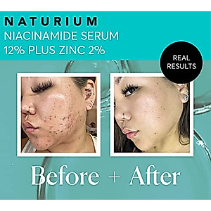 Naturium Niacinamide Face Serum 12% Plus Zinc 2%, Hyaluronic Acid & Vitamin E, Pore Minimizer, Discoloration & Aging Skin Treatment, 1 oz