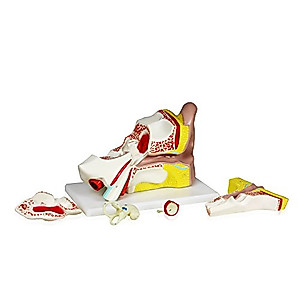 Parco Scientific PB00066-CC3 4X Ear | External, Middle & Inner Ear | 5 Removable Pieces Include Temporal Bone, Auditory Canal, Labyrinth, Tympanic Membrane, Malleus and Incus | W Key & Carrying Case