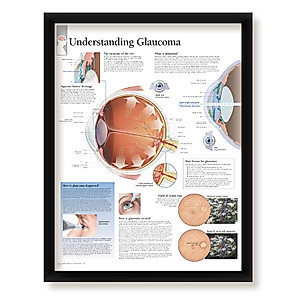 Set of 2 Framed Medical Posters The Eye and Understanding Glaucoma 22"x28" Wall Diagrams
