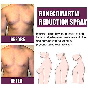 Gynecomastia Reduction Spray, Gynecomastia Chest Tightening Spray Reduction Cellulite Spray, Auchest Chest Cellulite Burner Spray, Prevent Sagging Chest Slim Down (30ml)