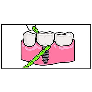 IDontix Brace X-Floss, Green