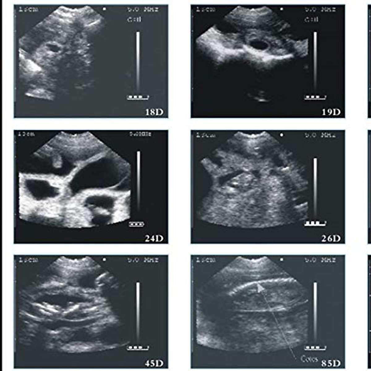 MLSJM Ultrasound Scanner,Pig Veterinary Ultrasound Scanner Machine Kit,Veterinary Farm Animals for Pig Pregnancy, Rechargeable Smart B-Ultrasound Handscan