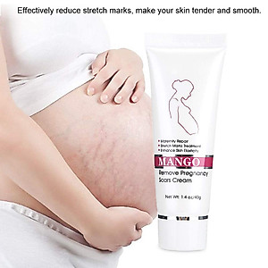 Stretch Mark Cream, Scar Cream Removal Cream Scars Essence Stretch Mark Repair Cream Stretch Scars Remove Acne Cream Stretch Mark Treatment Maternity Repair