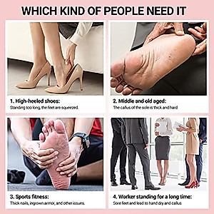 MelodySusie 10 Pcs Nail Sanding Caps Nail Drill Bits 180 Fine Grit for Foot File Callus Remover Manicure Pedicure Nail Polishing Burr Home Salon, Purple (10mm)