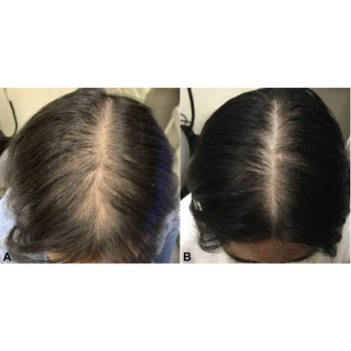 Organic Hair Solution-Hair Growth Pomade Grease with Peppermint-Mango Butter-Tea Tree - Argan- Jojoba seed- Avocado- Castor oil- For Scalp and Hair-For Stronger, Thicker Longer Hair-NOURISH & STRENGTH