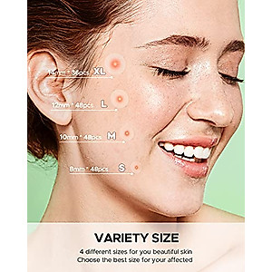 ZATKTK Acne Pimple Patch (180 Counts 4 Sizes), Invisible Hydrocolloid Acne Patch with Tea Tree Oil & Calendula Oil, Acne Spot Healing Patch Zit Patches for Face