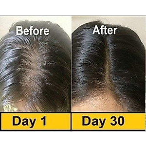 Merck Ltd. 50 Evion Capsules Vitamin E For Glowing Face,Strong Hair,Acne,Nails, Glowing Skin 400mg