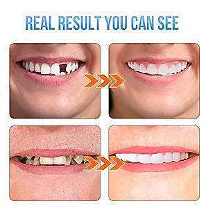 Fake Teeth,2PCS Dentures Cosmetic Teeth for Upper and Lower Jaw,Natural Shade and Comfortable Fit,Veneer Dentures for Women and Men-A03