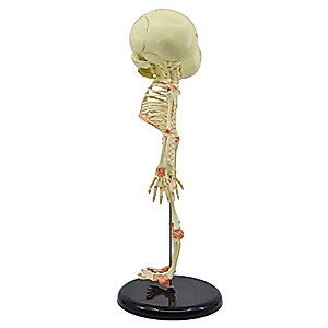 Infant Fetus Skeleton Model, Mini Size - Twin, Conjoined Skull - Rod Mounted - Incredible Detail for Anatomical Study - Eisco Labs