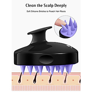 HEETA Hair Scalp Massager Shampoo Brush 2 Pack, Soft Silicone Bristles to Remove Dandruff, Waterproof Hair Scrubber for Both Wet Dry Hair, Suitable for Men & Women (Green & Black)