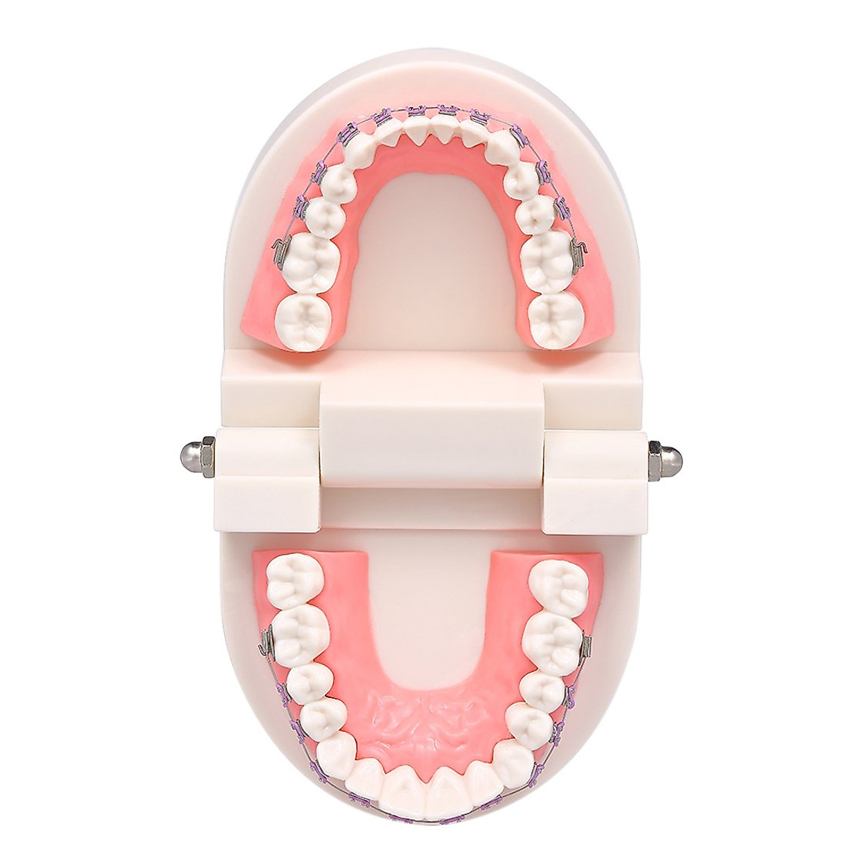 Angzhili 1 Piece Dental Demonstration Orthodontic Model with Metal Wires and Bracket (Metal bracket)