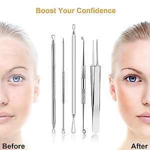 Pimple Popper Tool Kit, UUBAAR 9 PCS Blackhead Remover Tools with Tweezers, 16-Heads Professional Acne Zit Pimple Popper Extraction Tools, Whitehead Comedone Extractor Kit for Facial Nose