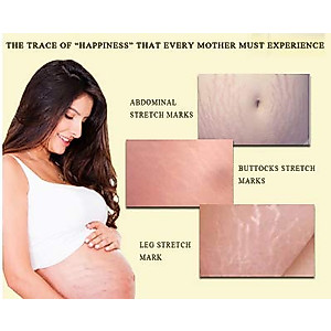 1pcs Remove Stretch Marks Cream Anti Wrinkle Anti Aging Maternity Skin Repair Remove Pregnancy Scars Treatment Body Skin Care