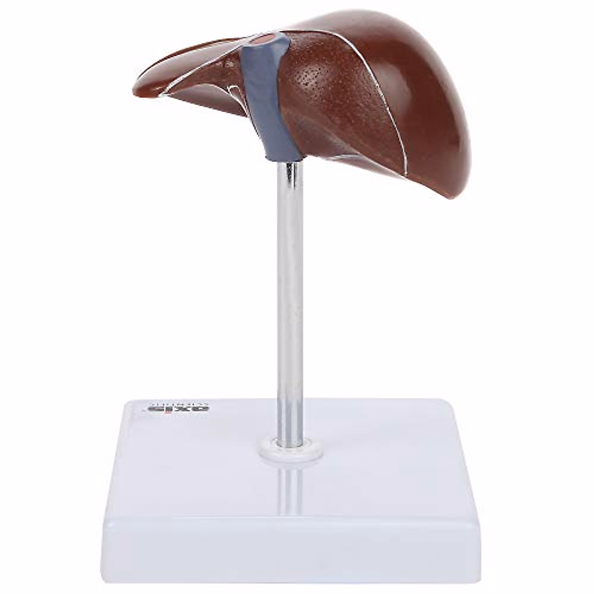 Axis Scientific Anatomy Model of Diseased Liver | Model is 1/3 Life-Size and Divides in 2 Parts | Shows 6 Liver Diseases and Abnormalities | Comes on a White Base