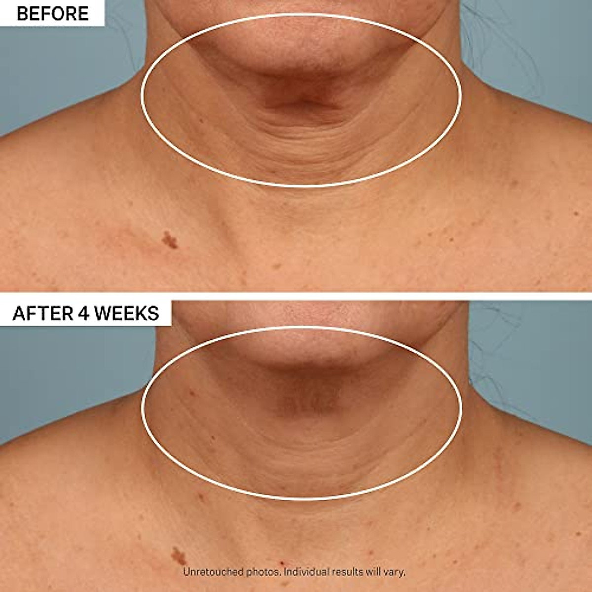 StriVectin Tighten and Lift Advanced Neck Cream PLUS, Anti-Aging Firming and Brightening Complex, 0.25 Fl Oz