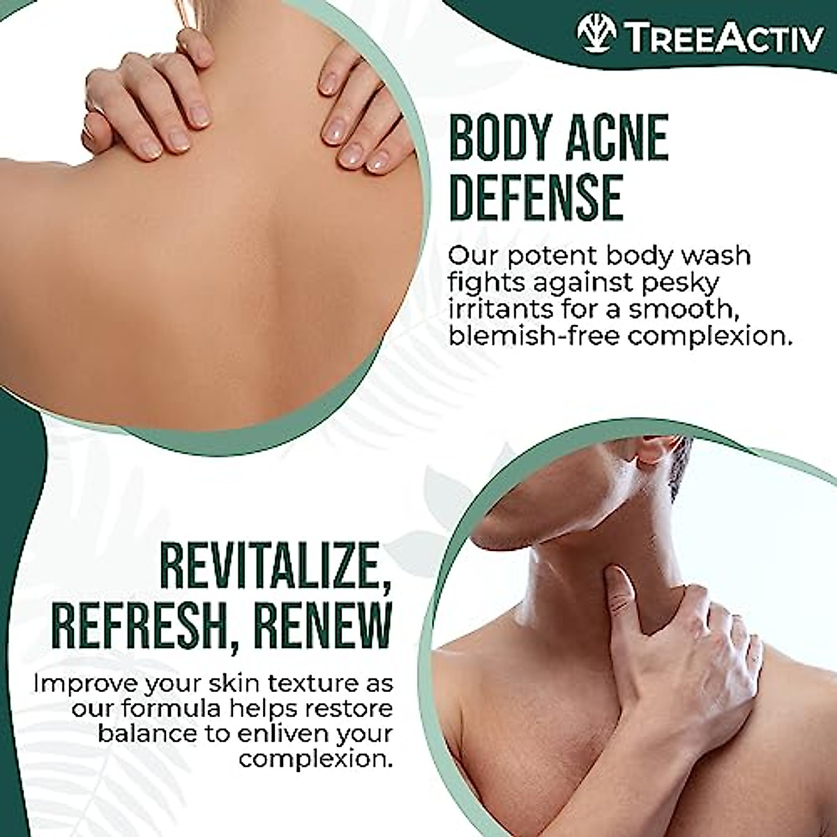 TreeActiv Acne Exfoliating Body Wash, 8oz, Foam Cleanser for All Skin Types, Sulfur, Aloe Vera, Jojoba Beads