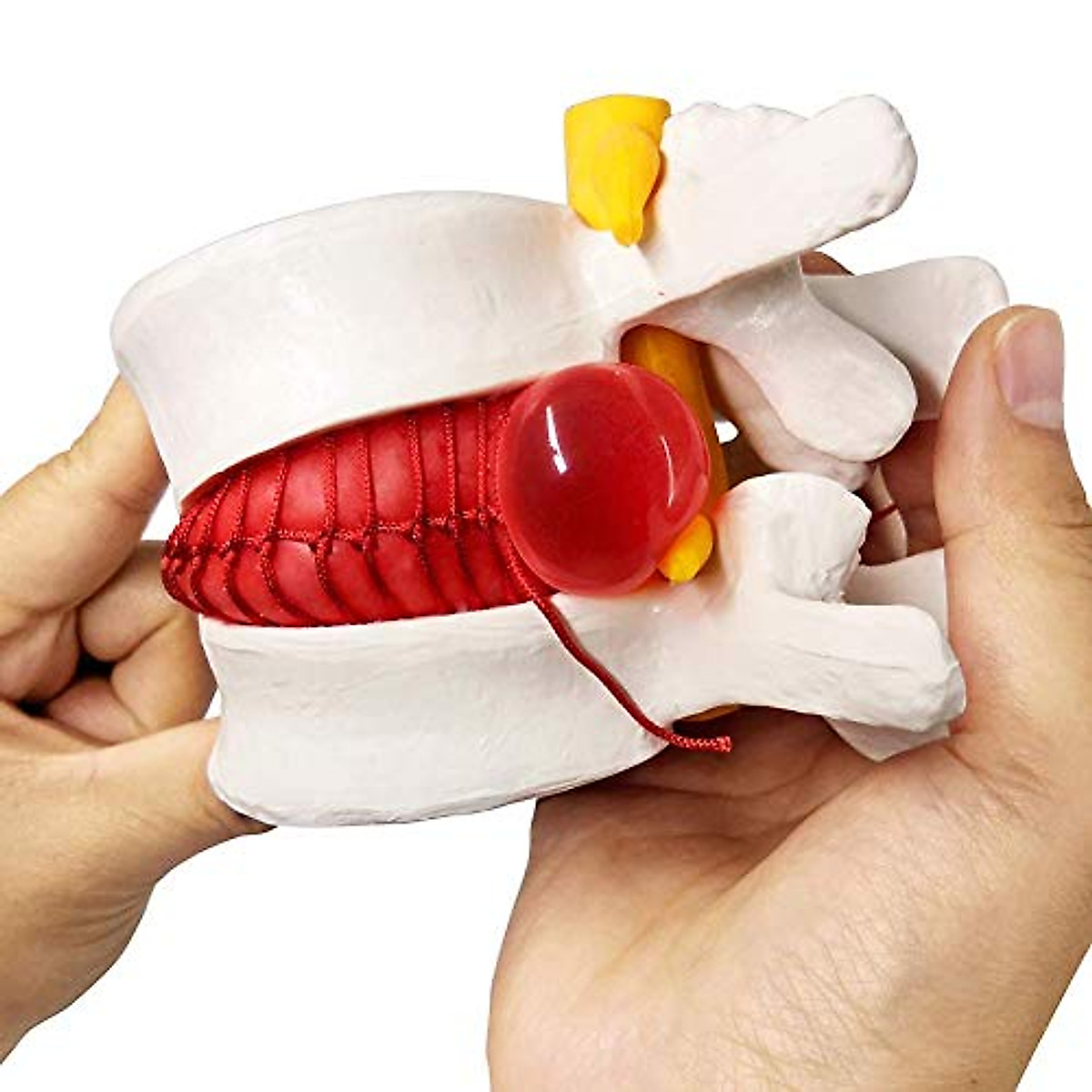 Human Herniated Disc Model, Anatomical Herniated Lumbar Vertebrae Disc Prolapse Model for Medical Teaching Learning, Education Display Tooling, Kids Learning Education Display Tool 2 Pack