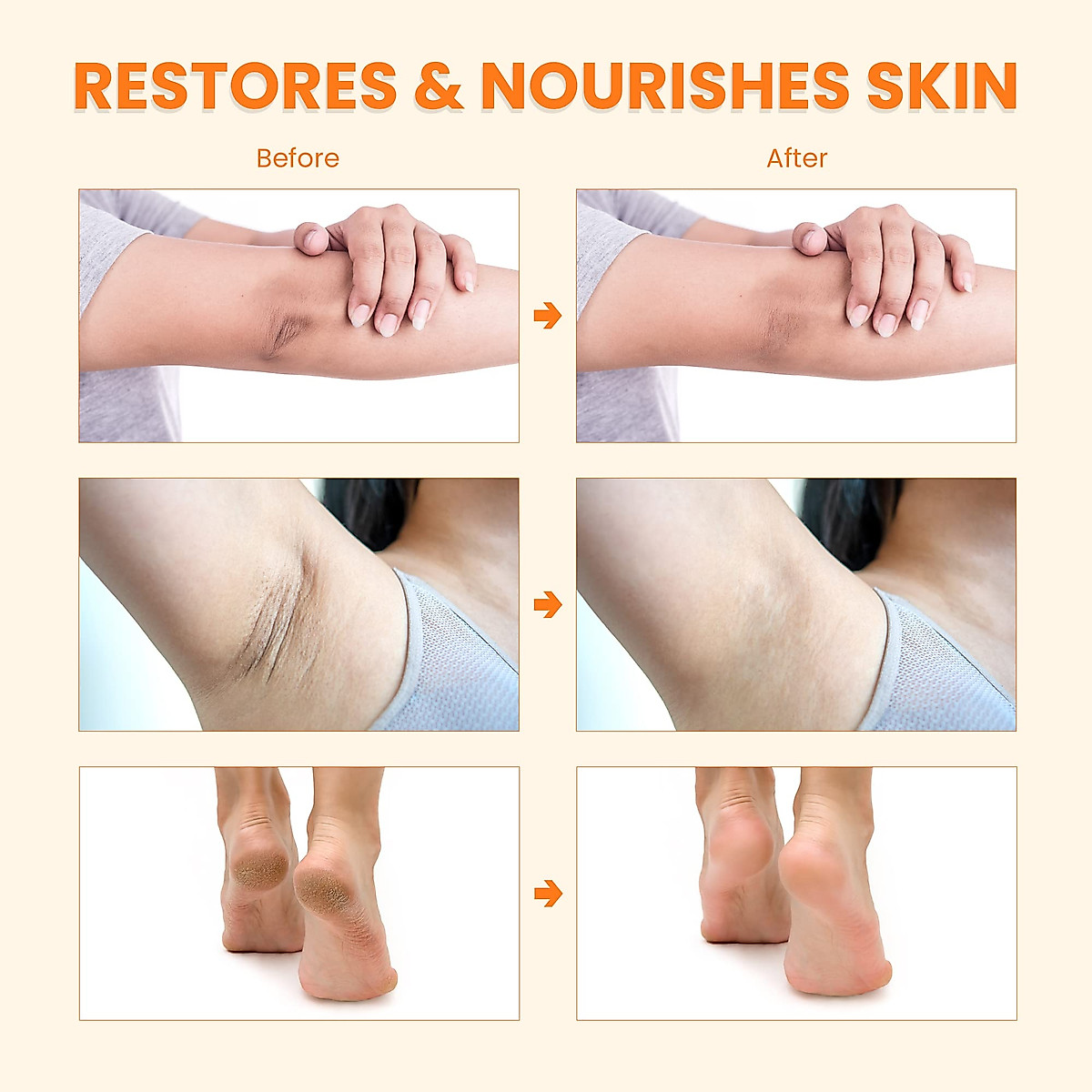 Dark Spot Cream, Brightening Cream, Underarm Cream for Armpit, Skin, Body, Elbows, Knees, Neck, Private Areas