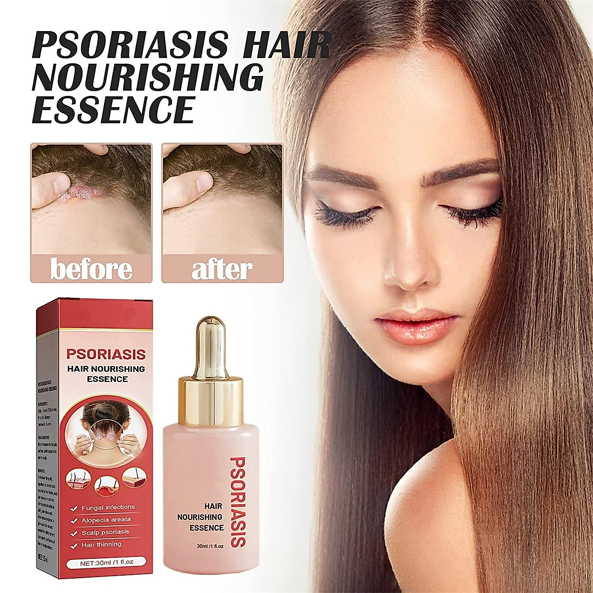 CPO Fᴏlliᴄle Nᴏᴜrishing Hairgrᴏᴡth Serᴜm, Hair Revival Serum,Hair Loss & Hair Thinning Serum for Hair Loss and Dry Damaged,Hair Regrowth Essence for Women Men-30ml (2PCS)