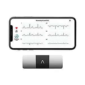 KardiaMobile 6-Lead Personal EKG Monitor – Six Views of The Heart – Detects AFib and Irregular Arrhythmias – Instant Results in 30 Seconds – Works with Most Smartphones - FSA/HSA Eligible