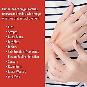 Sovereign Silver First Aid Gel – Topical Healing Homeopathic Medicine, 1 oz.