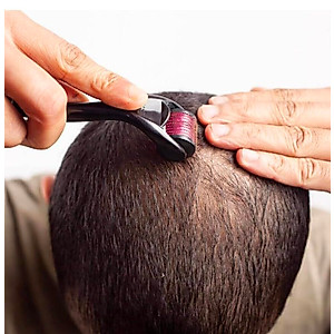 RadBizz Derma Roller and Storage Case - 0.25mm