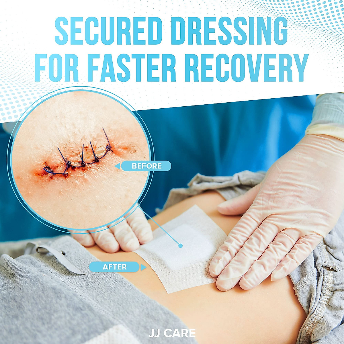 JJ CARE Soft Surgical Tape [Pack of 4], 2” x 10 Yards Soft Cloth Tape, Latex-Free Cloth Medical Tape for First Aid, Breathable Cloth Surgical Tape, Hypoallergenic Adhesive