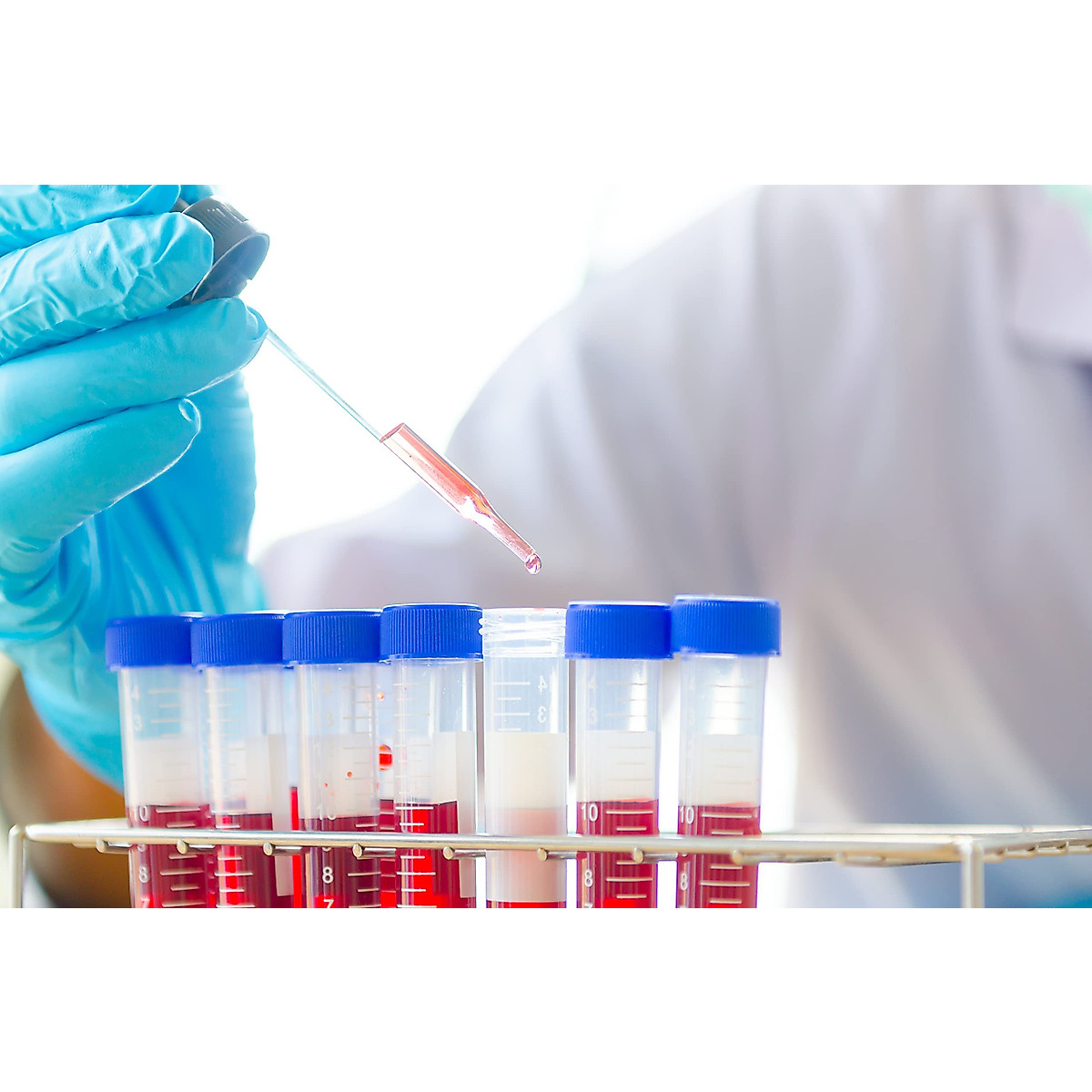 Ackers Conical Centrifuge Tubes 15mL, 100 Pcs Sterile Plastic Test Tubes with Screw Caps, Polypropylene Container with Graduated and Write-on Spot, Non-Pyrogenic, DN/RNase Free