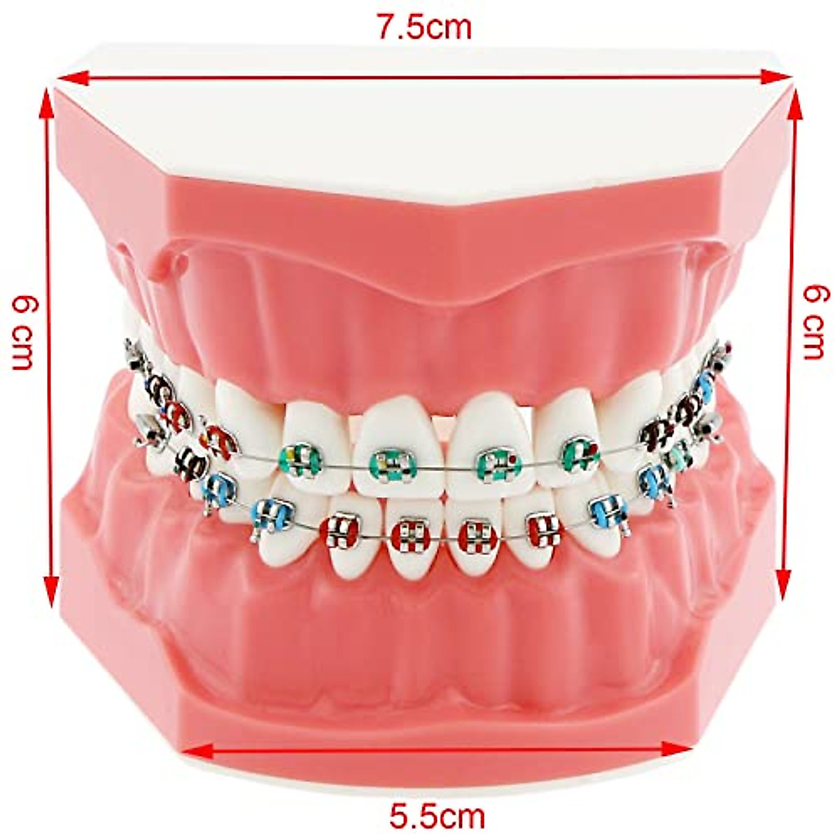 Dentalmall Typodonts Orthodontics Demonstration Model with Metal Wires and Bracket Teaching, Learning, Interpretation Model for Adults and Children (Metal Bracket)