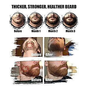 Beard Growth Kit, Beard Kit with Beard Roller, 2 Pack Beard Growth Oil & Growth Serum Spray, Beard Growth Wash, Beard Brush,Beard Comb, Stocking Stuffers Fathers Gifts for Men Dad Boyfriend